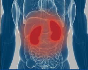 What is Sepsis-Associated Acute Kidney Injury?